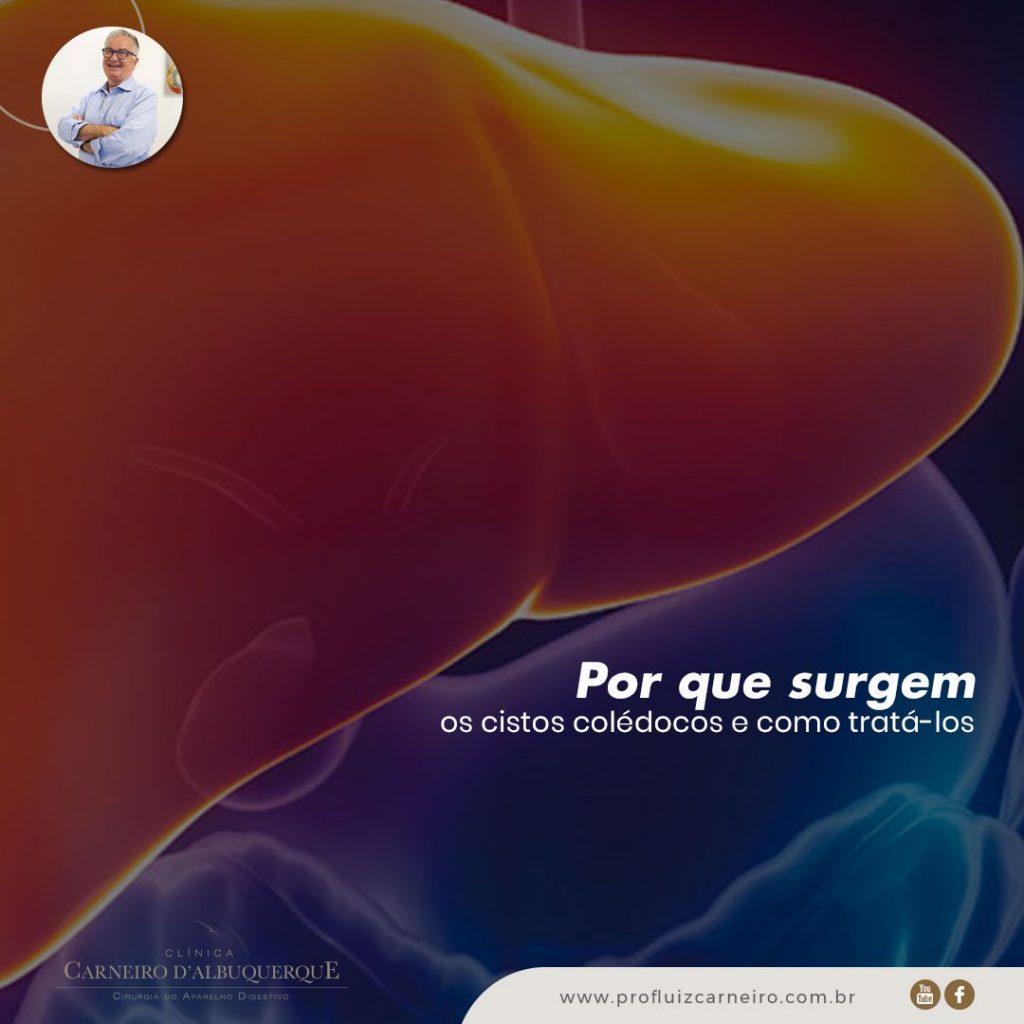 Cisto De Colédoco: Por Que Surge E Como Tratar - Prof Dr. Luiz Carneiro