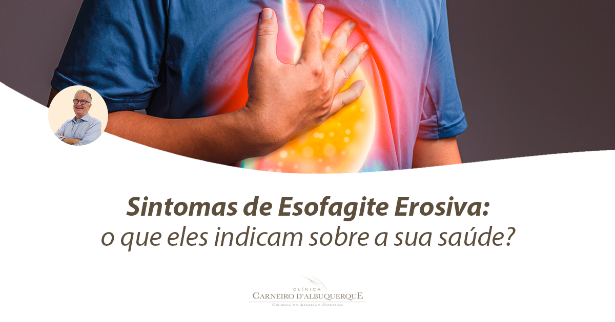 Sintomas De Esofagite Erosiva: O Que Eles Indicam Sobre A Sua Saúde ...