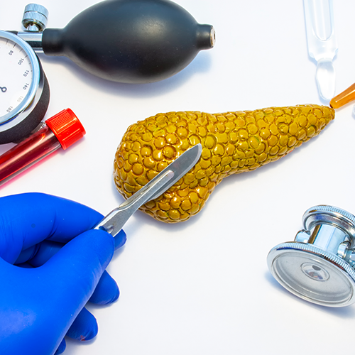 O Que é Pangastrite? Saiba Quais São Os Sintomas E O Tratamento - Prof ...